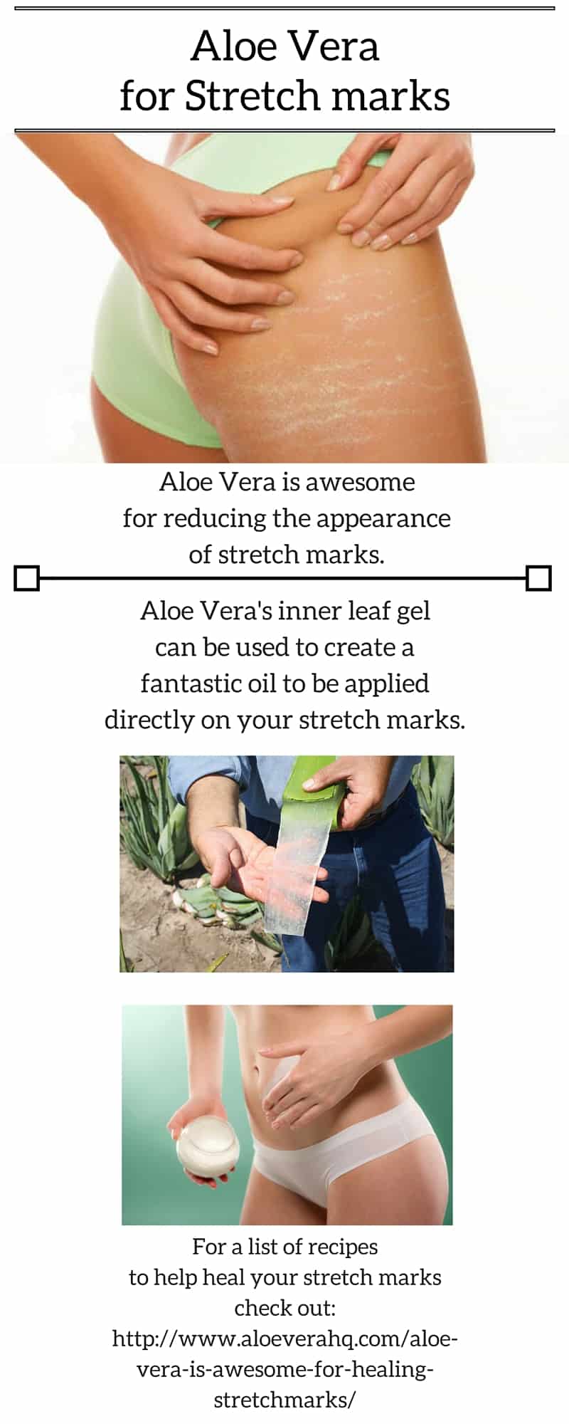 Aloe Vera Is Awesome For Healing Stretchmarks Aloe Vera